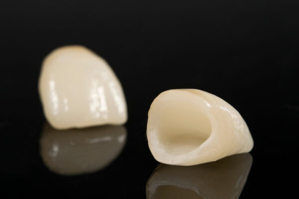 Full ceramic crowns - Cosmetic Dentistry - Dental Clinic Crete